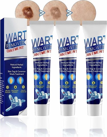 Elecsera Warts Remover Cream Skin Face Tag Treatment Ointment For Men ...